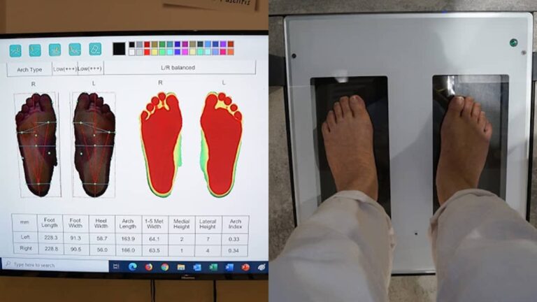 Ini Yang Perlu Korang Faham Pasal Tapak Kaki Rata - Santai Sini